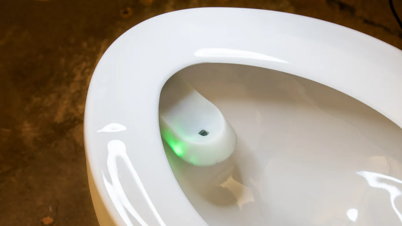 Starling Medical’s new urine-testing device turns your toilet into a ...